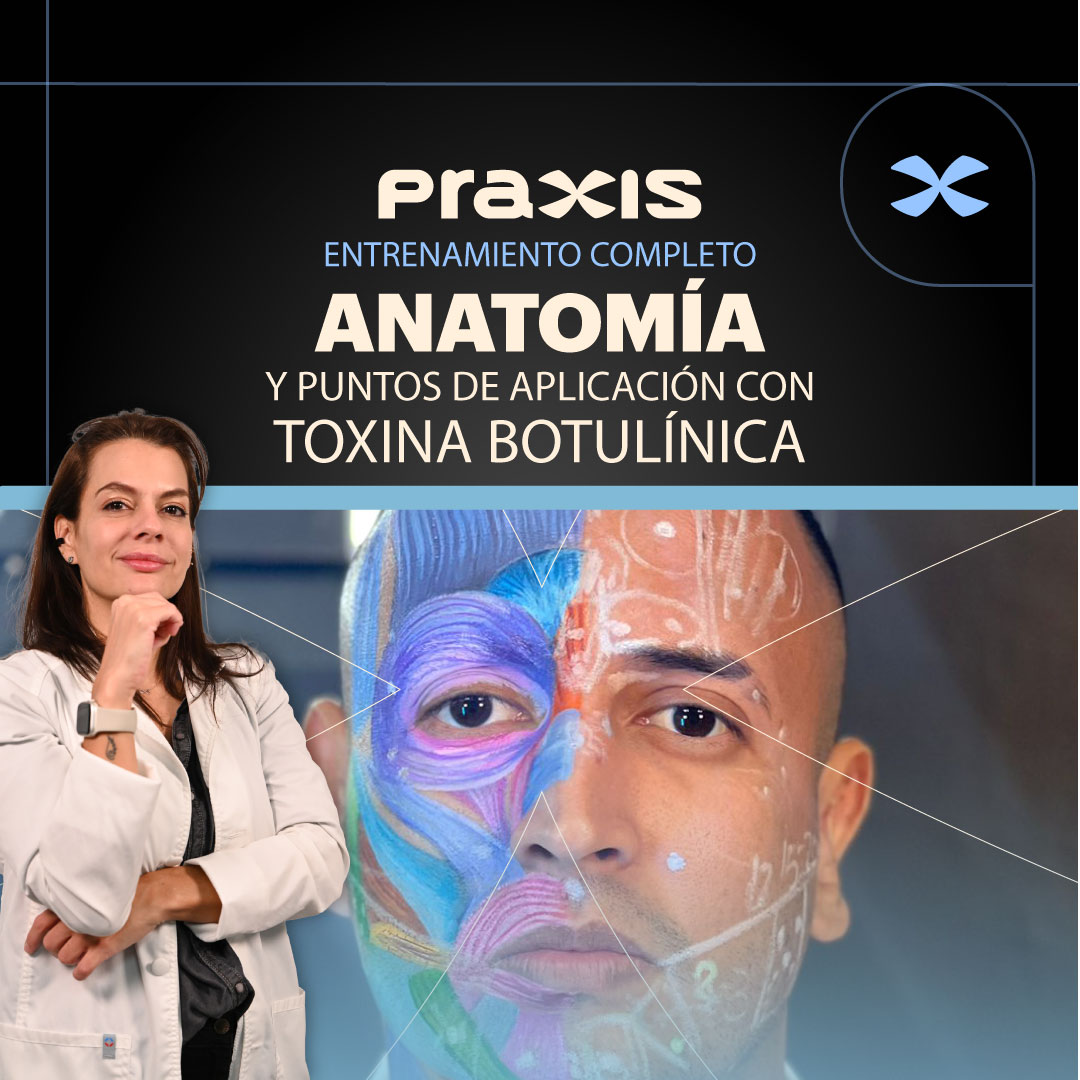 Anatomía y puntos de aplicación de toxina botulínica + Microdosis