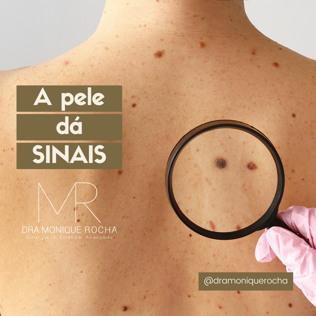 A Pele dá Sinais: Um Guia Completo para AUTOEXAME e Prevenção do câncer ...
