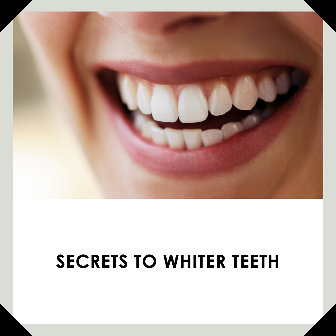 Secrets of Whiter Teeth