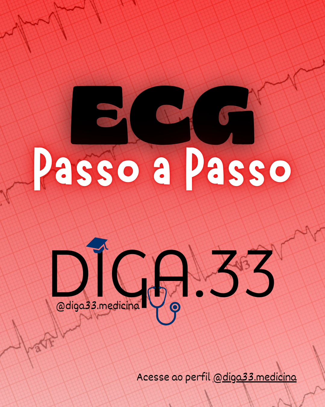 ECG Passo a Passo - Juliano Froder | Hotmart