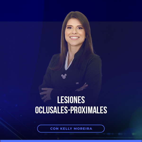 Lesiones oclusales-proximales - M2 TREINAMENTO E DESENVOLVIMENTO PE...