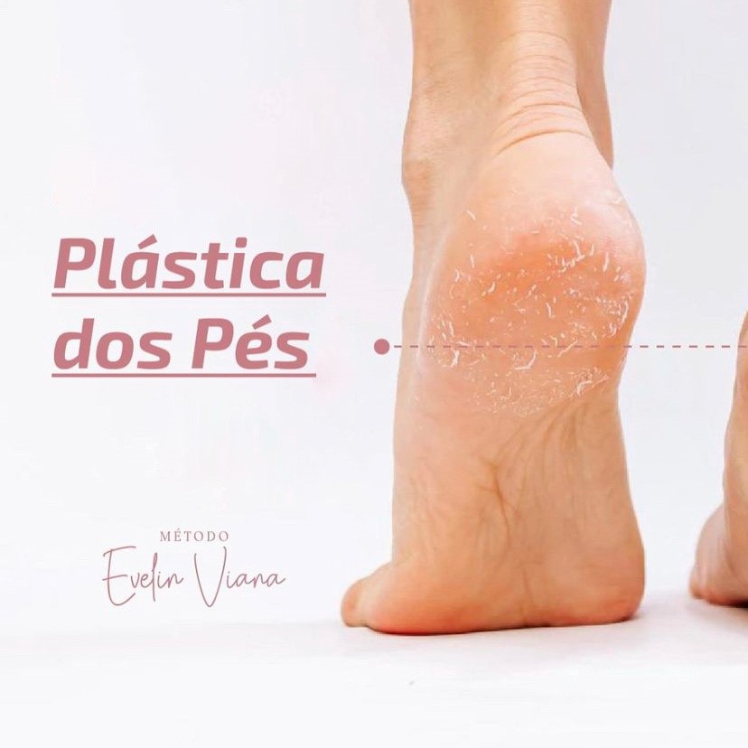 Plástica dos Pés - Método Evelin Viana