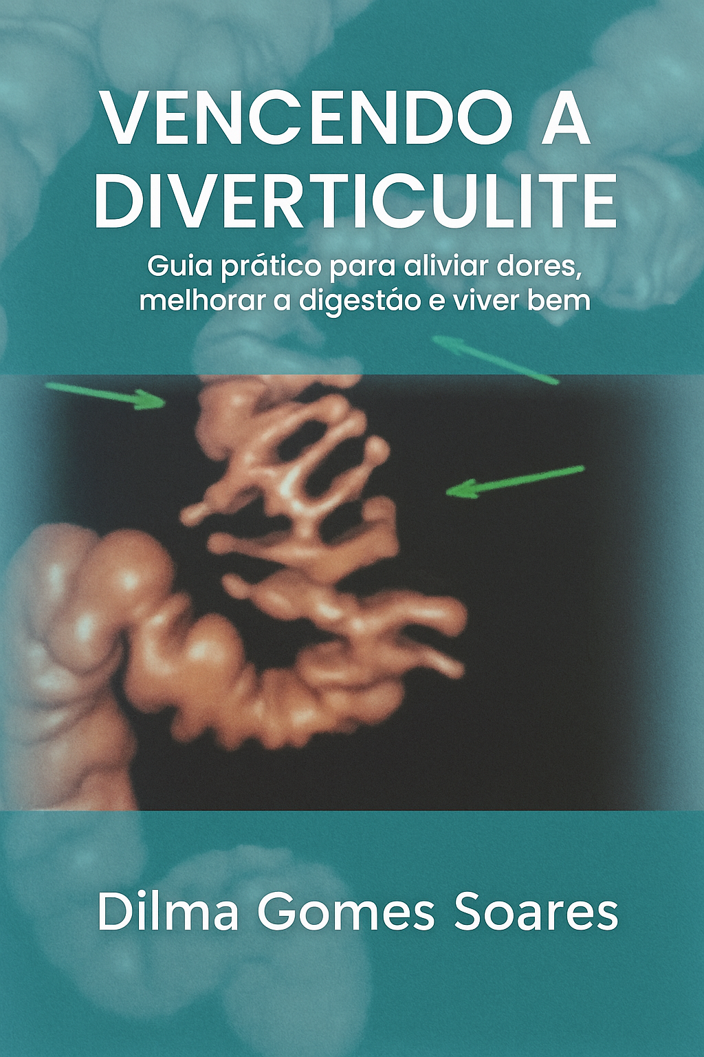 Vencendo a Diverticulite - DILMA GOMES SOARES | Hotmart