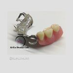 PPR Metálica Removible Diseño Digital, (Del Escaneo hasta el Pulido).