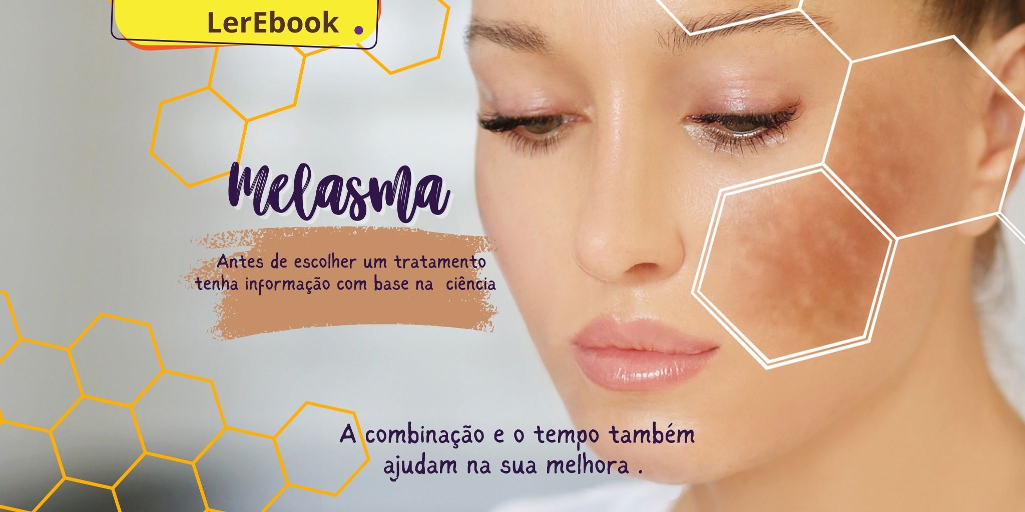 MELASMA : GUIA Holístico Científico PARA UMA PELE MELHOR - Müller ...