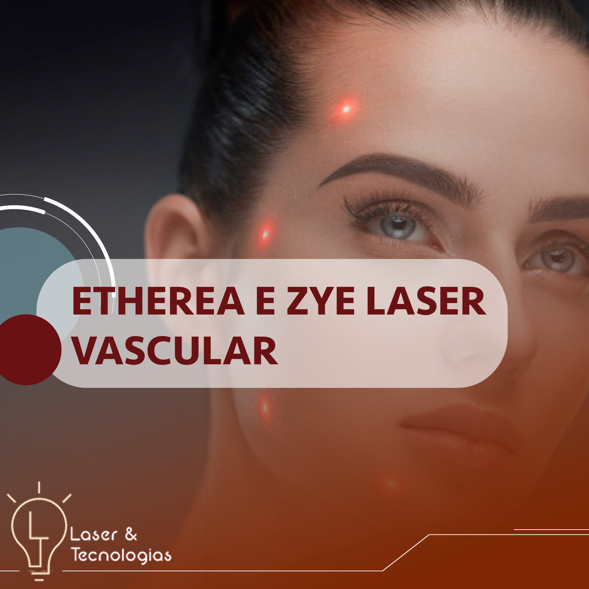 ETHEREA E ZYE LASER VASCULAR - Laser & Tecnologias | Hotmart
