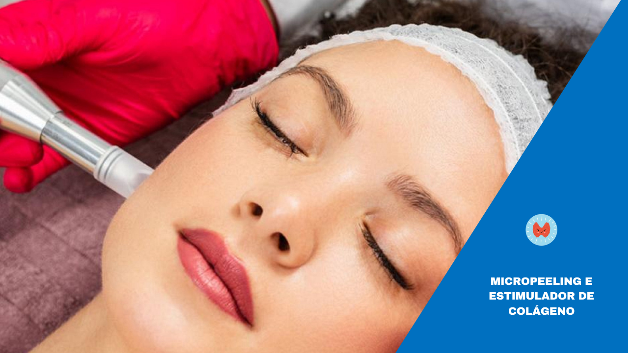 MICROPEELING EFEITO BLUR - PROTOCOLO DE MICROAGULHAMENTO - - HORMO...