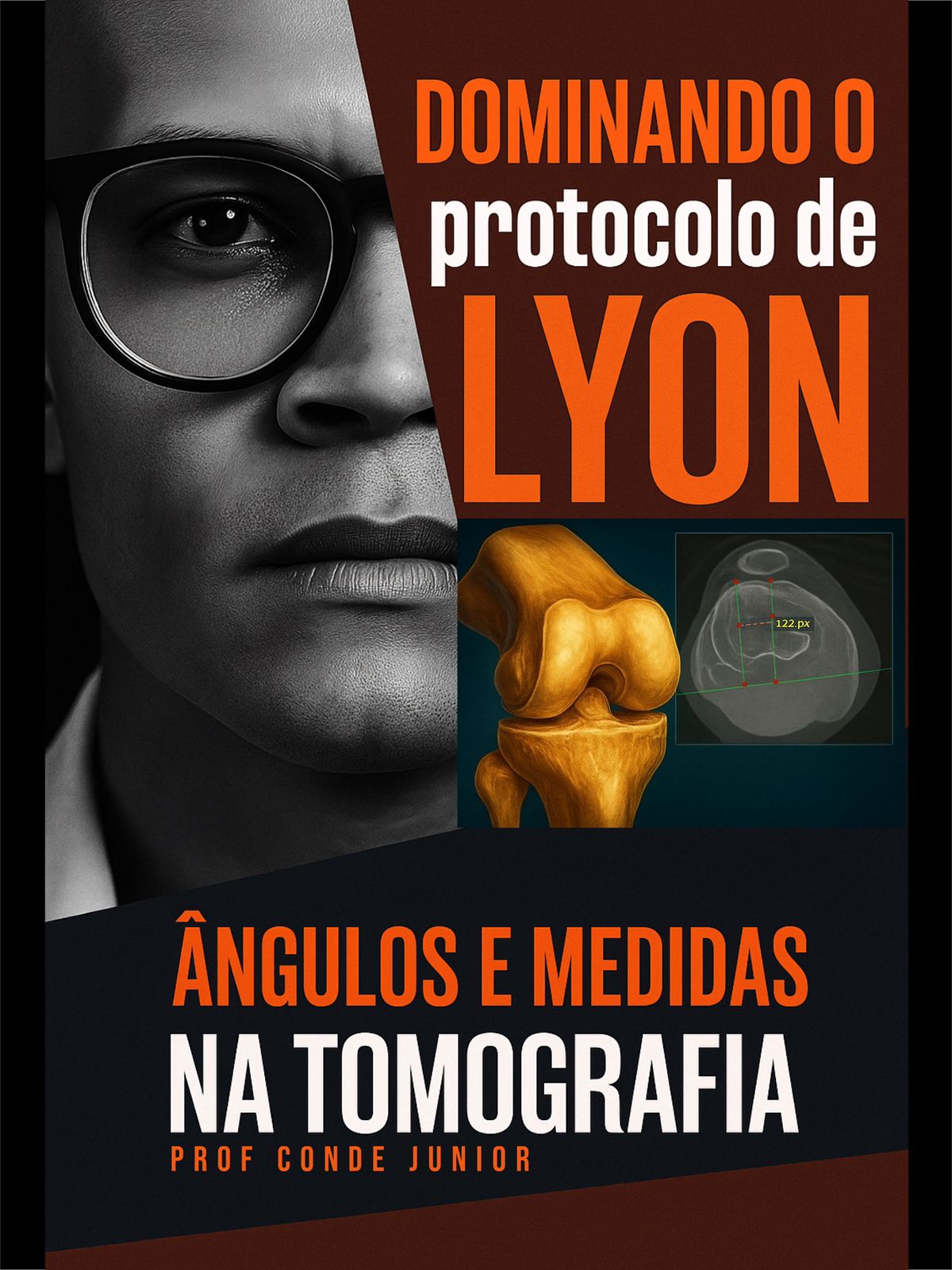 AULA + LIVRO PROTOCOLO DE LYON - Prof. Conde Junior | Hotmart