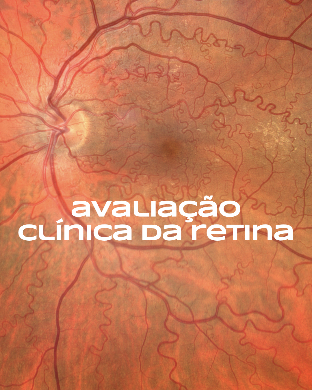 Avaliação clínica da retina - Orbit | Hotmart