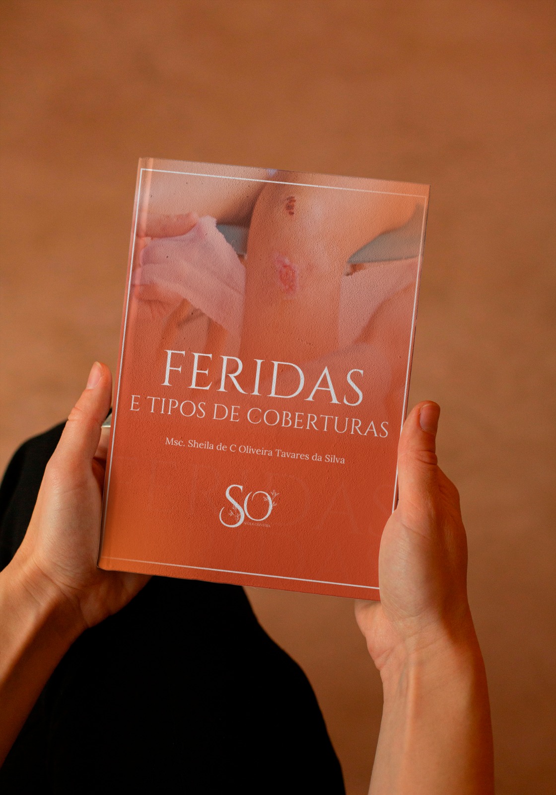 GUIA PRÁTICO SOBRE FERIDAS E TIPOS DE COBERTURA - Sheila Oliveira
