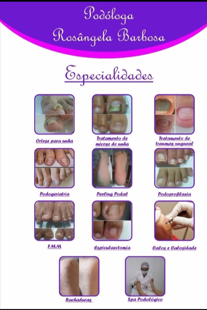 Unhas saudáveis e Belas - Rosangela Barbosa dos santos | Hotmart