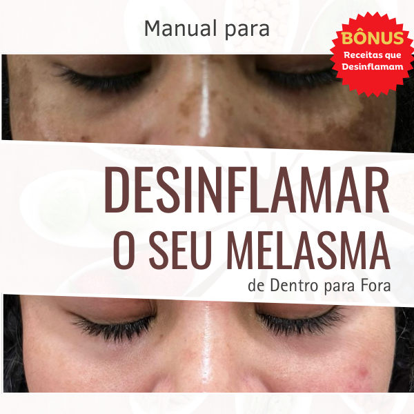 Manual para Desinflamar o Seu Melasma de Dentro para Fora - Aline G...