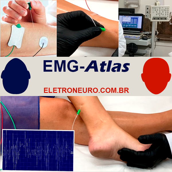 EMG Atlas de Eletromiografia - Módulo Membros Inferiores partes 1,...