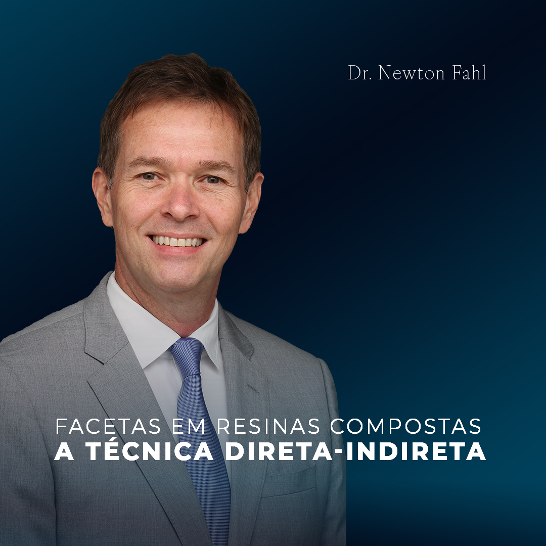 Facetas em Resinas Compostas - A Técnica Direta-Indireta | Hotmart