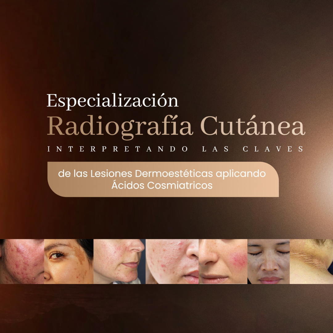 “Radiografía Cutánea: Interpretando las Claves de las Lesiones ...