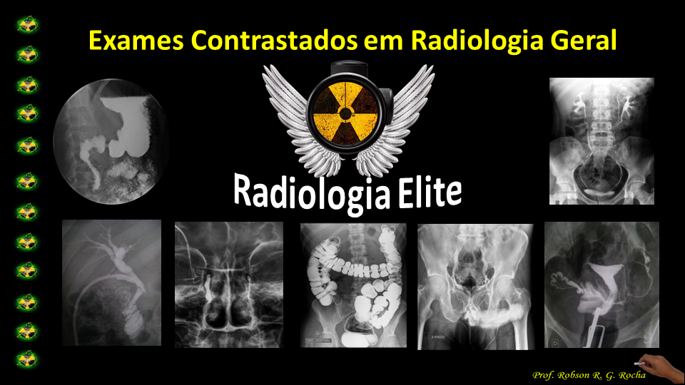 Exames Contrastados - RX - Robson R G Rocha | Hotmart