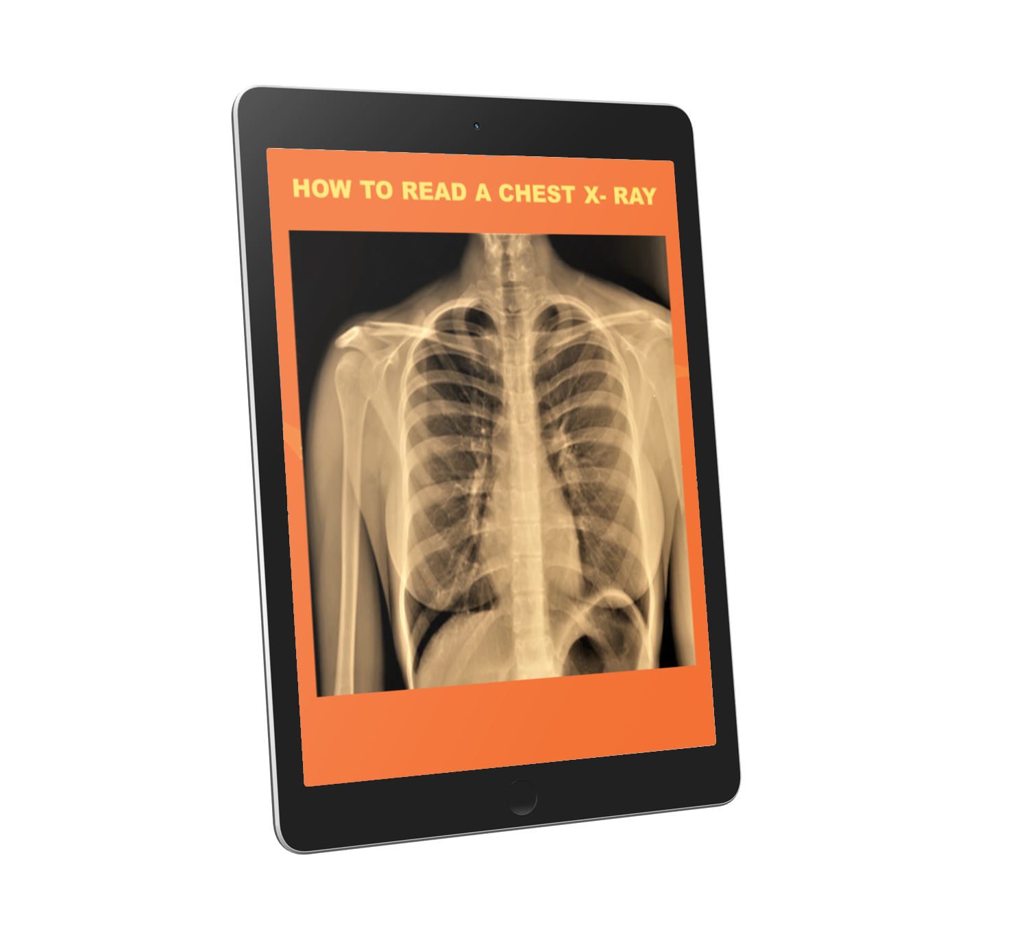 How to read a chest X- ray - Dra. Ianna Carmo | Hotmart
