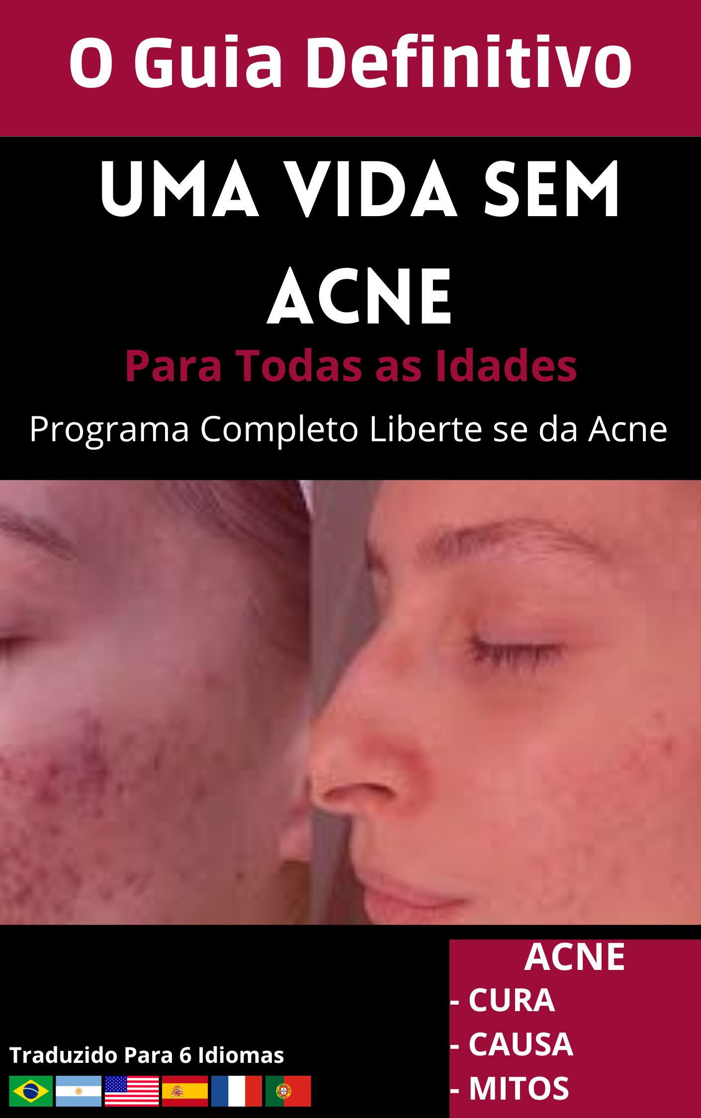 O Guia Definitivo - Uma Vida Sem Acne - ALISSON SENA DOS SANTOS | H...