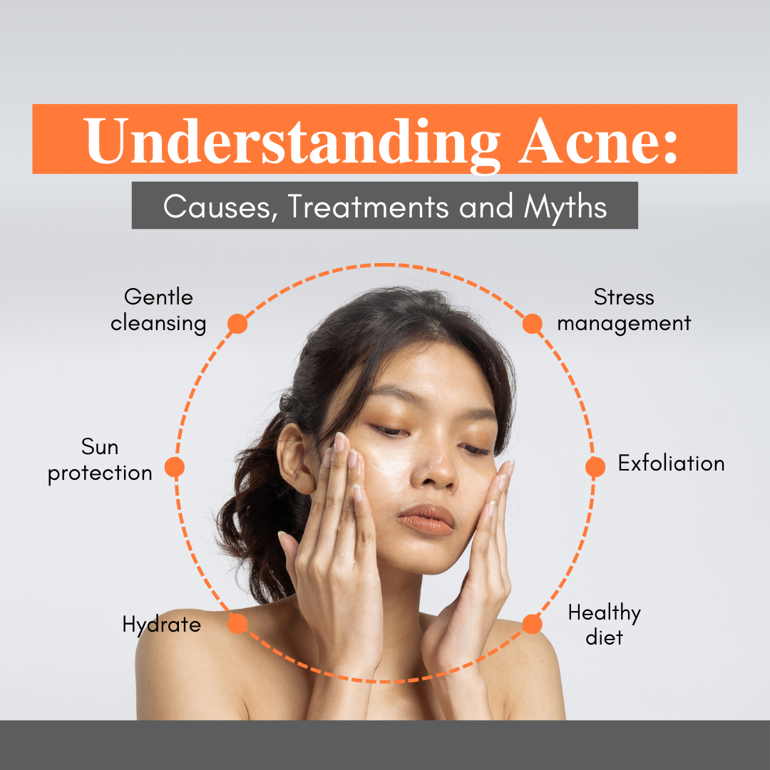 ·Understanding Acne: Causes, Treatments and Myths - Angie Vargas