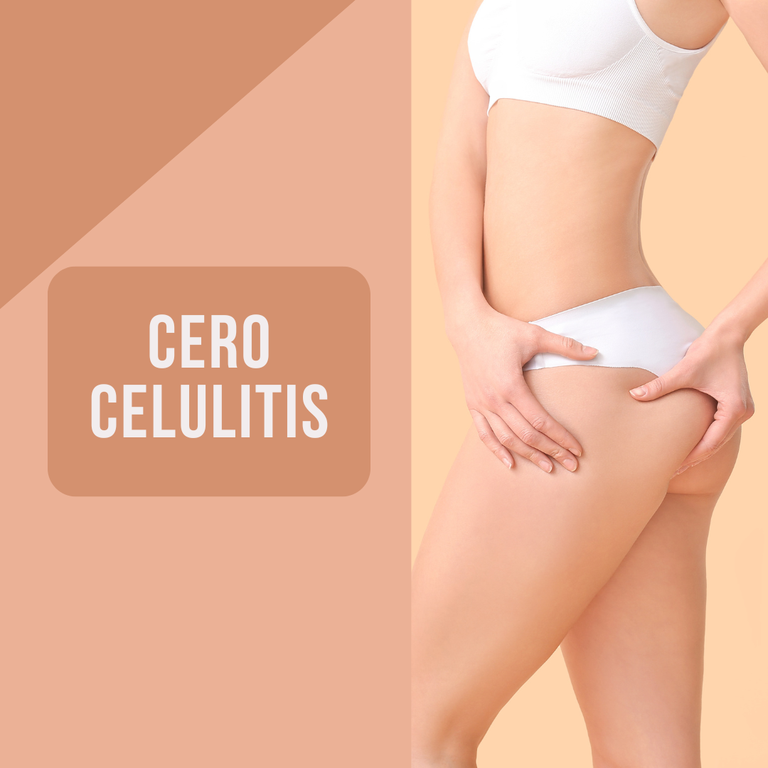 Cero Flacidez y Celulitis