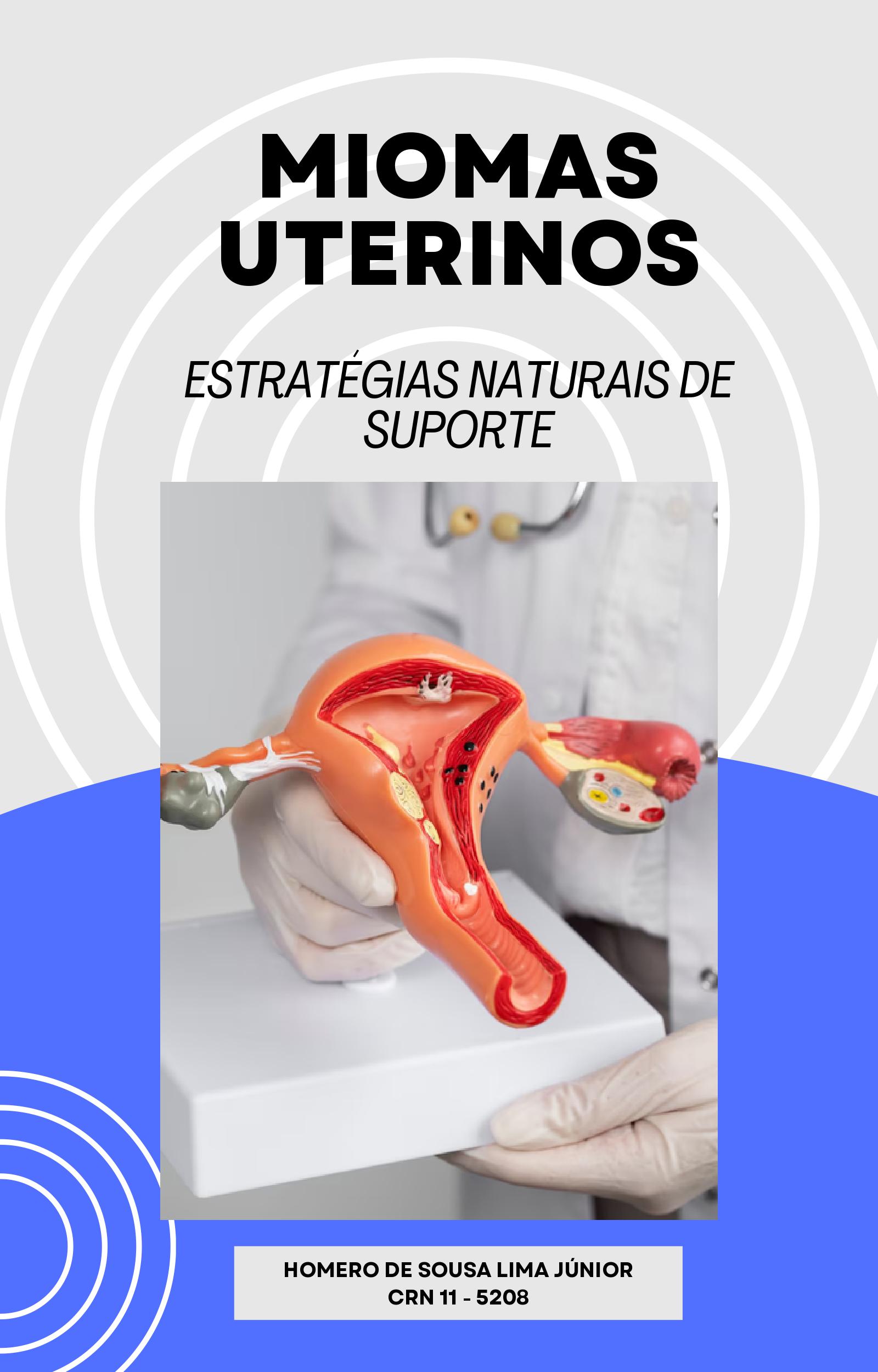 MIOMAS, ENDOMETRIOSE E SOP: ESTRATÉGIAS NATURAIS DE SUPORTE - HOMER...