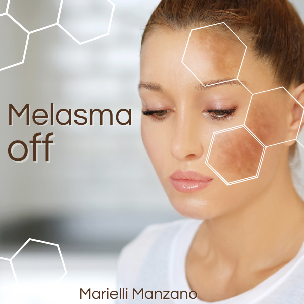 Melasma Off