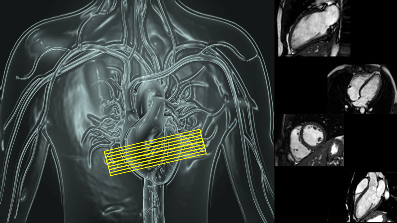 RM Cardiaca - Robson R G Rocha | Hotmart