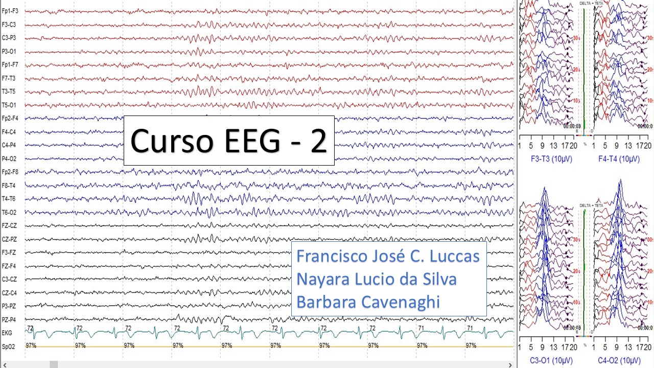 Curso EEG 2