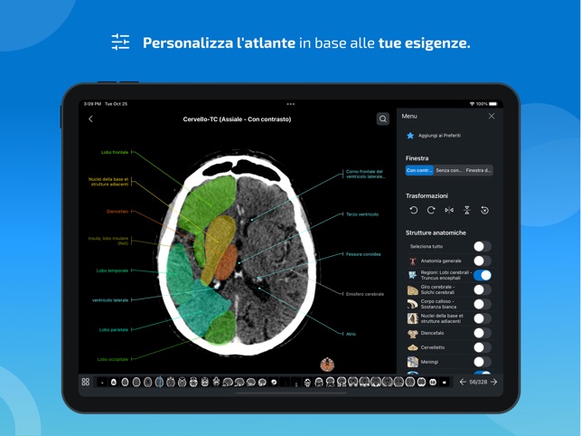 Anatomy (IMAIOS) - Apps Médicas | Hotmart