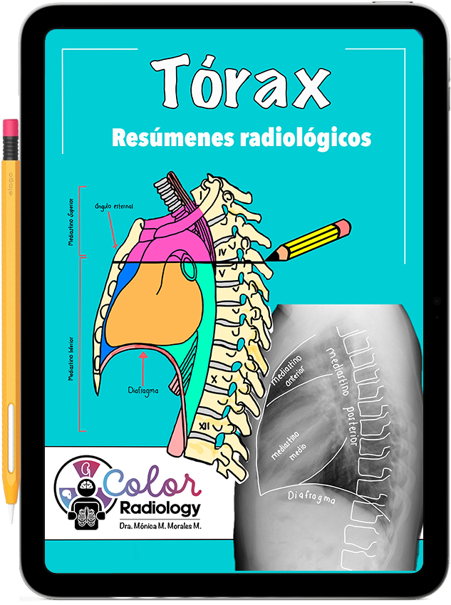 Resúmenes Radiológicos - TÓRAX