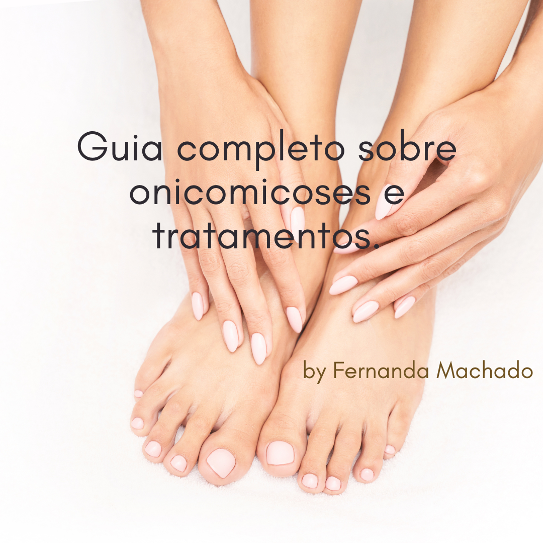 Guia completo sobre onicomicoses e tratamentos - Fernanda Machado p...