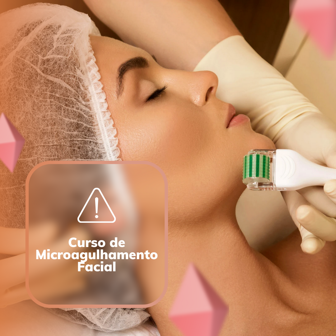 Tudo sobre Microagulhamento Facial: Ciência, Técnica e Resultados