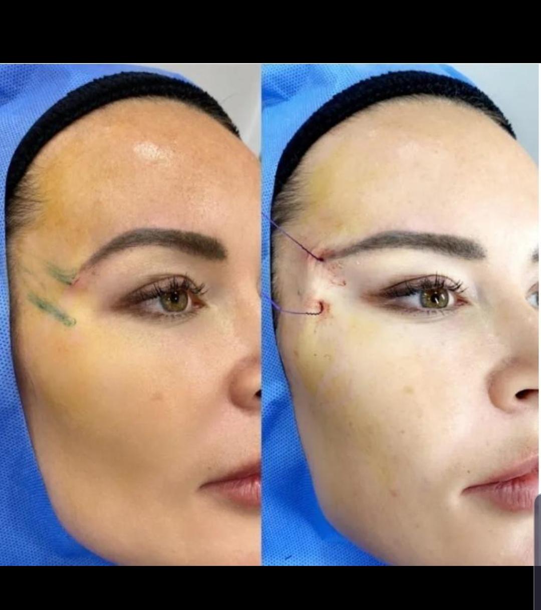 Curso de Fox Eyes com Fios em PDO - Cristiane C. dos Santos | Hotmart