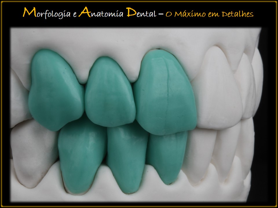 Morfologia e Anatomia Dental - O Máximo em Detalhes - Dentes Anteri...