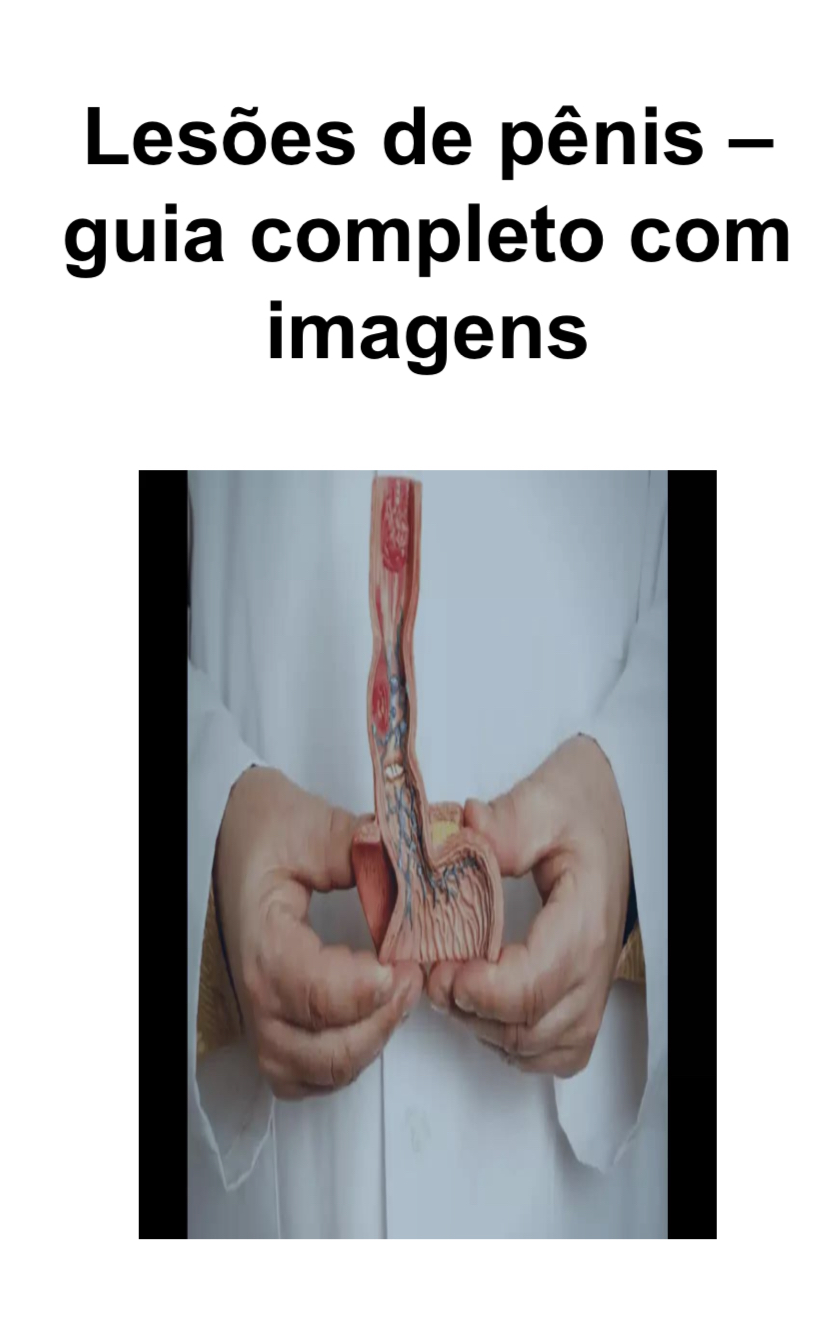 Lesões de pênis: guia completo com imagens - Germano Nogueira Leal ...