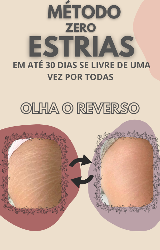 Método ZERO estrias em 28 Dias - Gustavo henrique | Hotmart