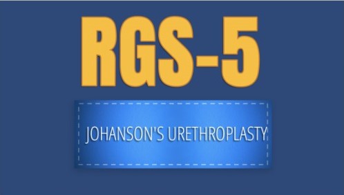 RGS5 - Johanson's urethroplasty