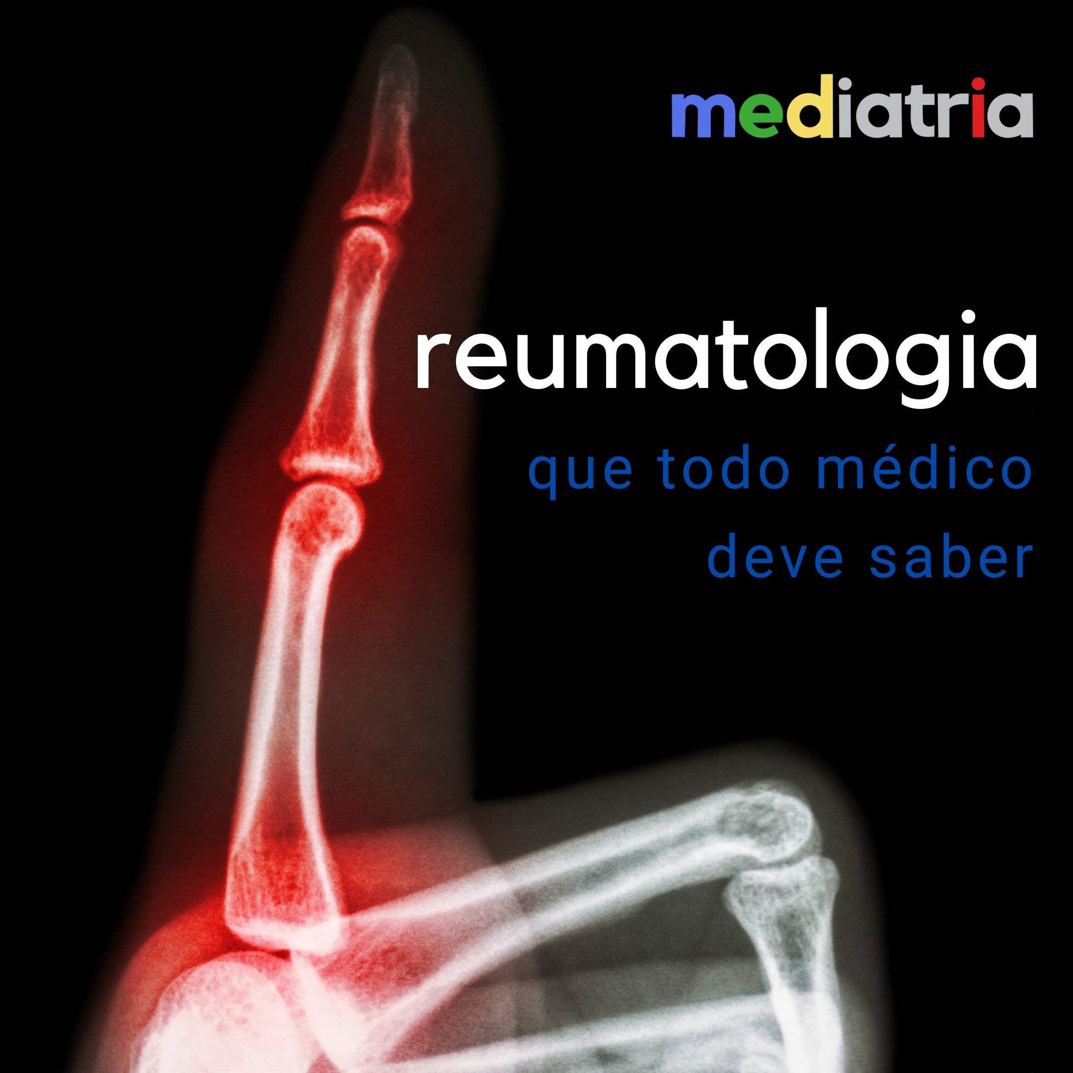Reumatologia Que Todo Médico Deve Saber