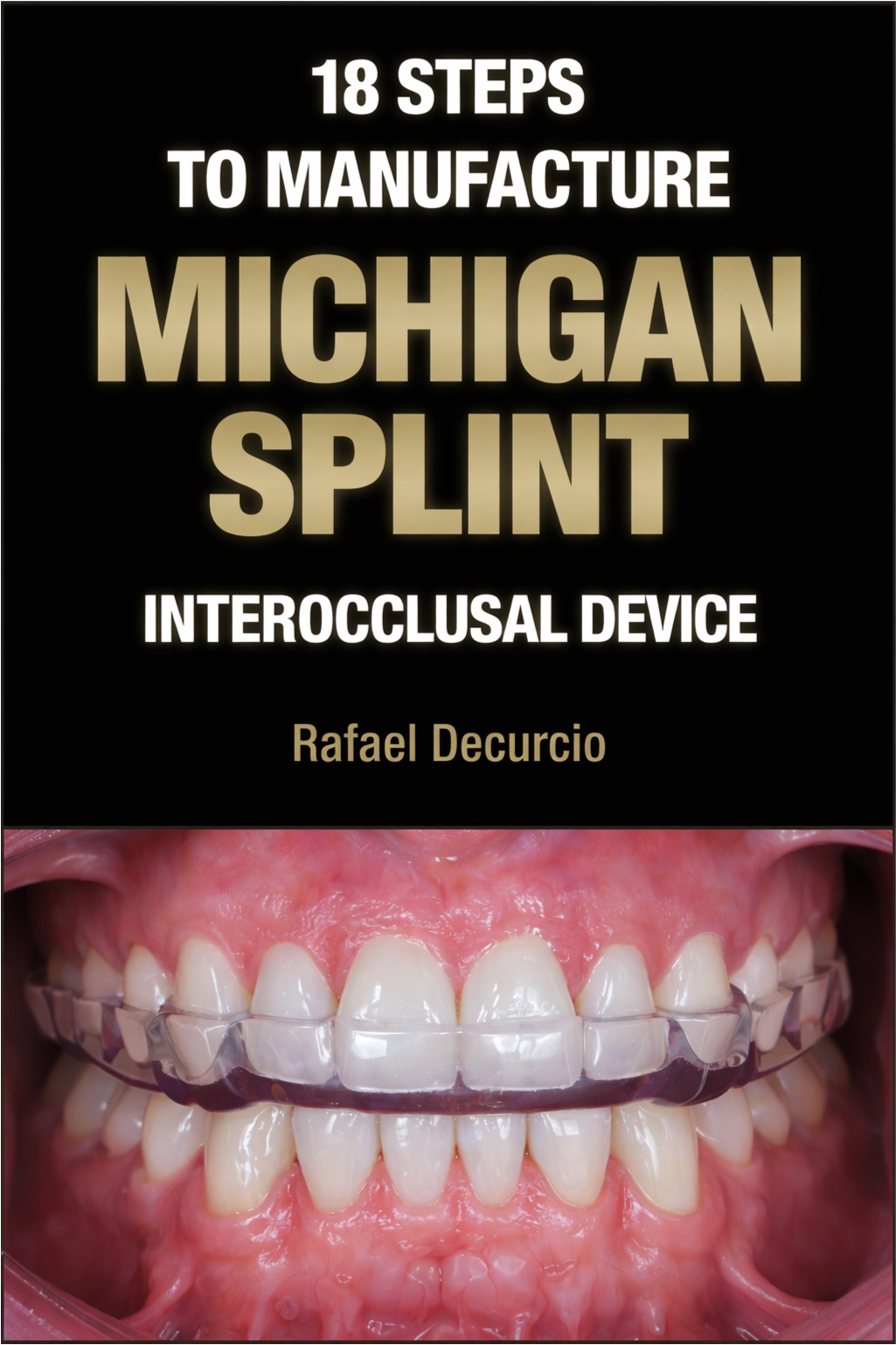 Michigan Splint Fabrication Manual: 18 Steps - Rafael Decurcio | Ho...