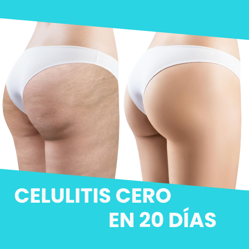Celulitis Cero en 20 Días - InfoCreators | Hotmart