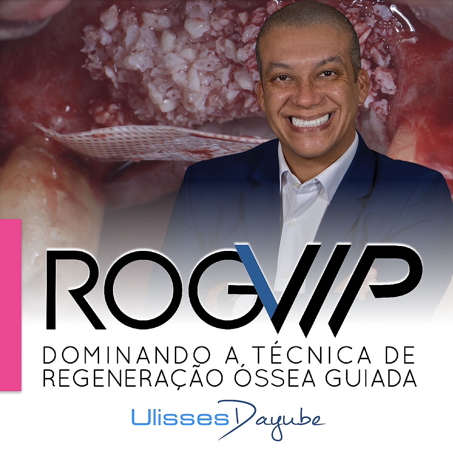 ROG VIP