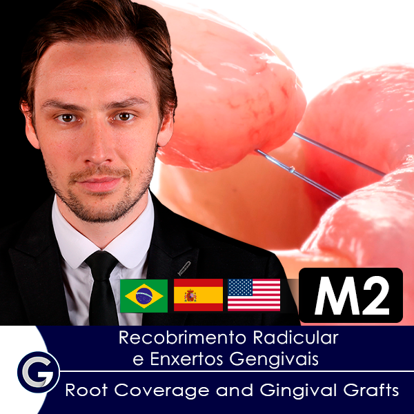 M2-Recobrimento Radicular e Enxertos Gengivais / Root Coverage and ...