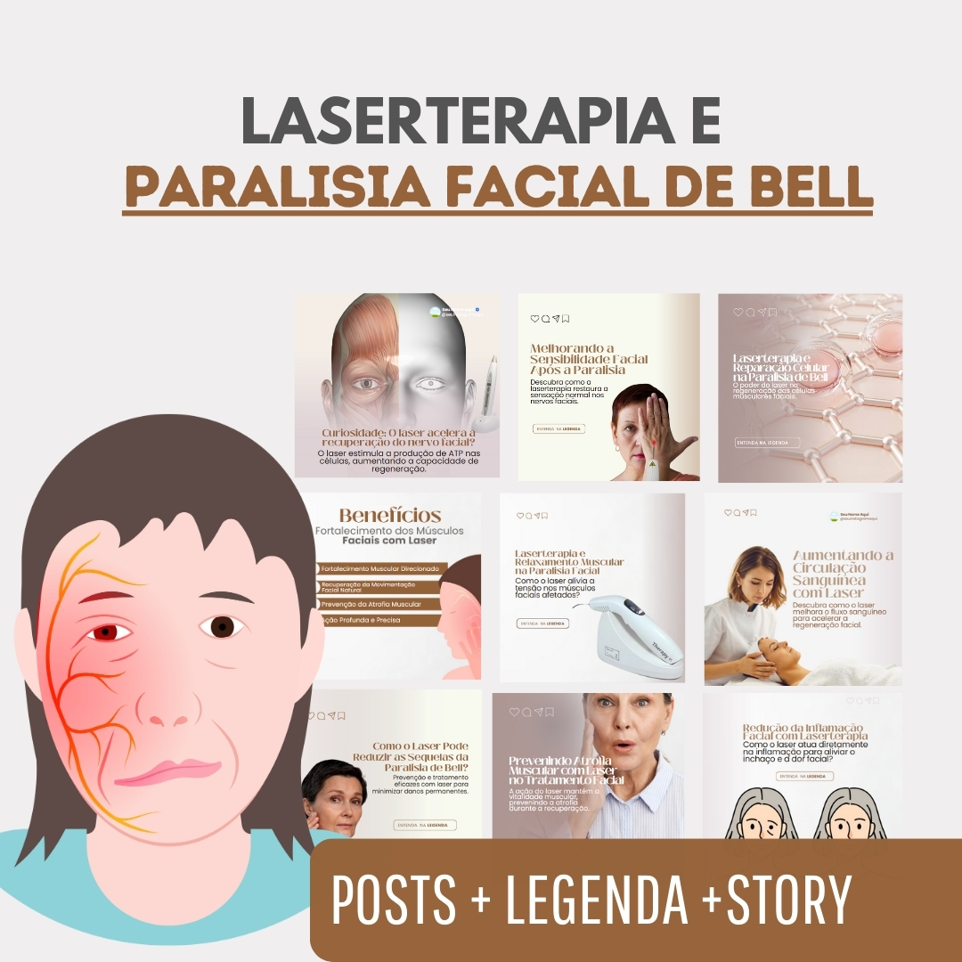 PACK DE LASERTERAPIA NO TRATAMENTO DE PARALISIA FACIAL DE BELL - Gi...