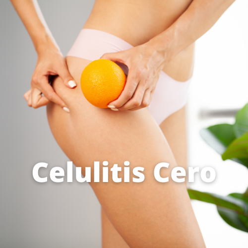 Celulitis Cero - Yglessyas santos | Hotmart