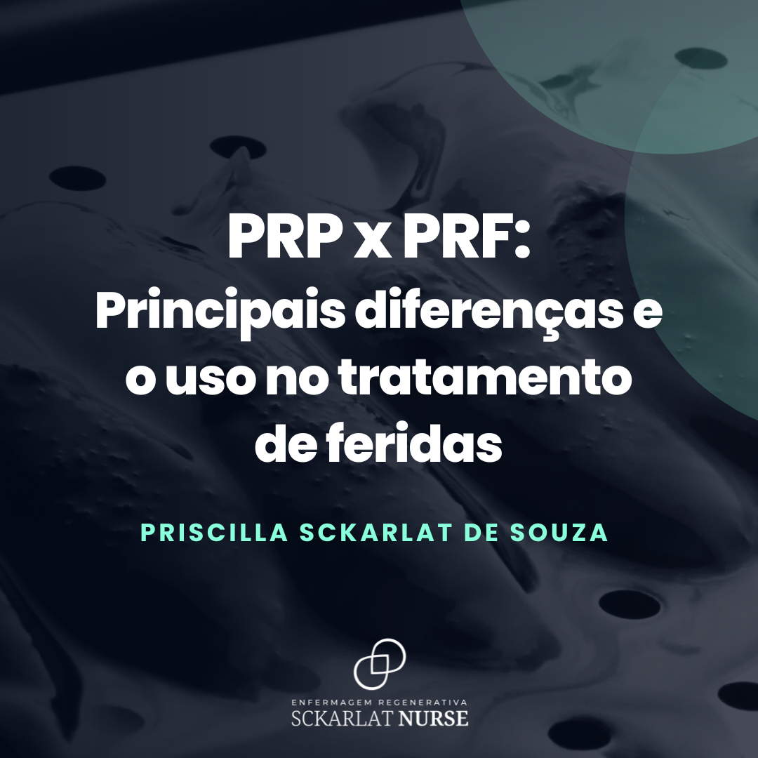 PRP X PRF: Principais diferenças e o uso no tratamento de Feridas