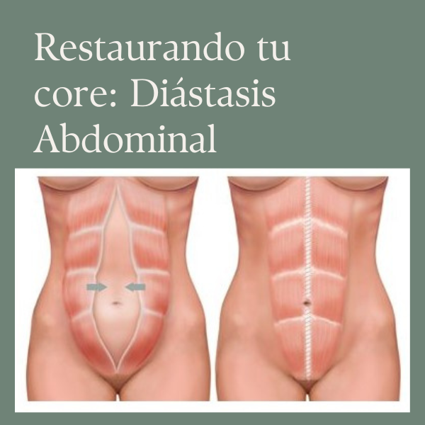 Restaurando tu core: Diástasis Abdominal - Yuriko sánchez silva