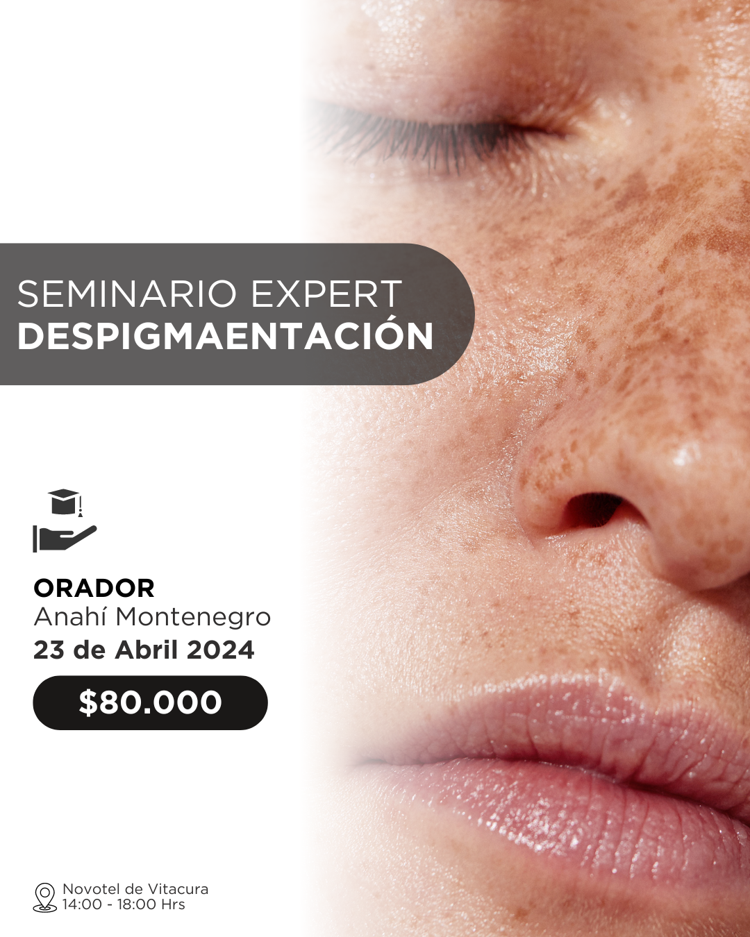 Seminario expert despigmaentación - Innexus Academy | Hotmart