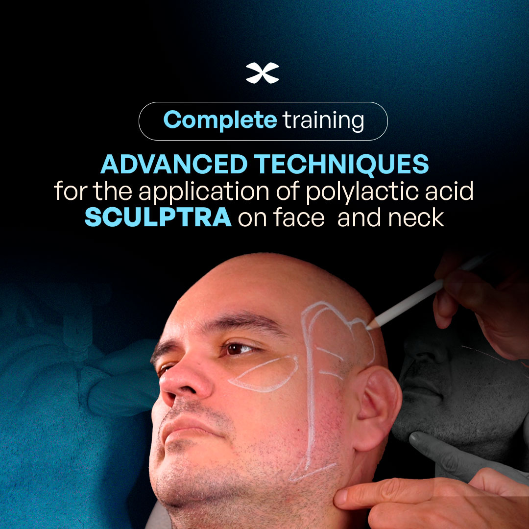 Advanced Techniques for Applying Poly-L-Lactic Acid Sculptra on the ...