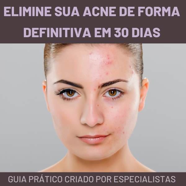 Acne Zero: Elimine sua acne de forma definitiva em 30 dias com o Mé...