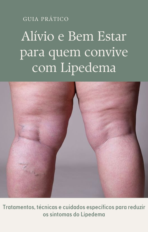 Descubra Como Aliviar os Sintomas do Lipedema e Viver com Mais Qual...